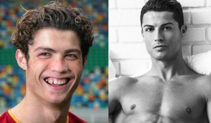 Cristiano Ronaldo prima e dopo - Rifatti - Chirurgia Estetica VIP