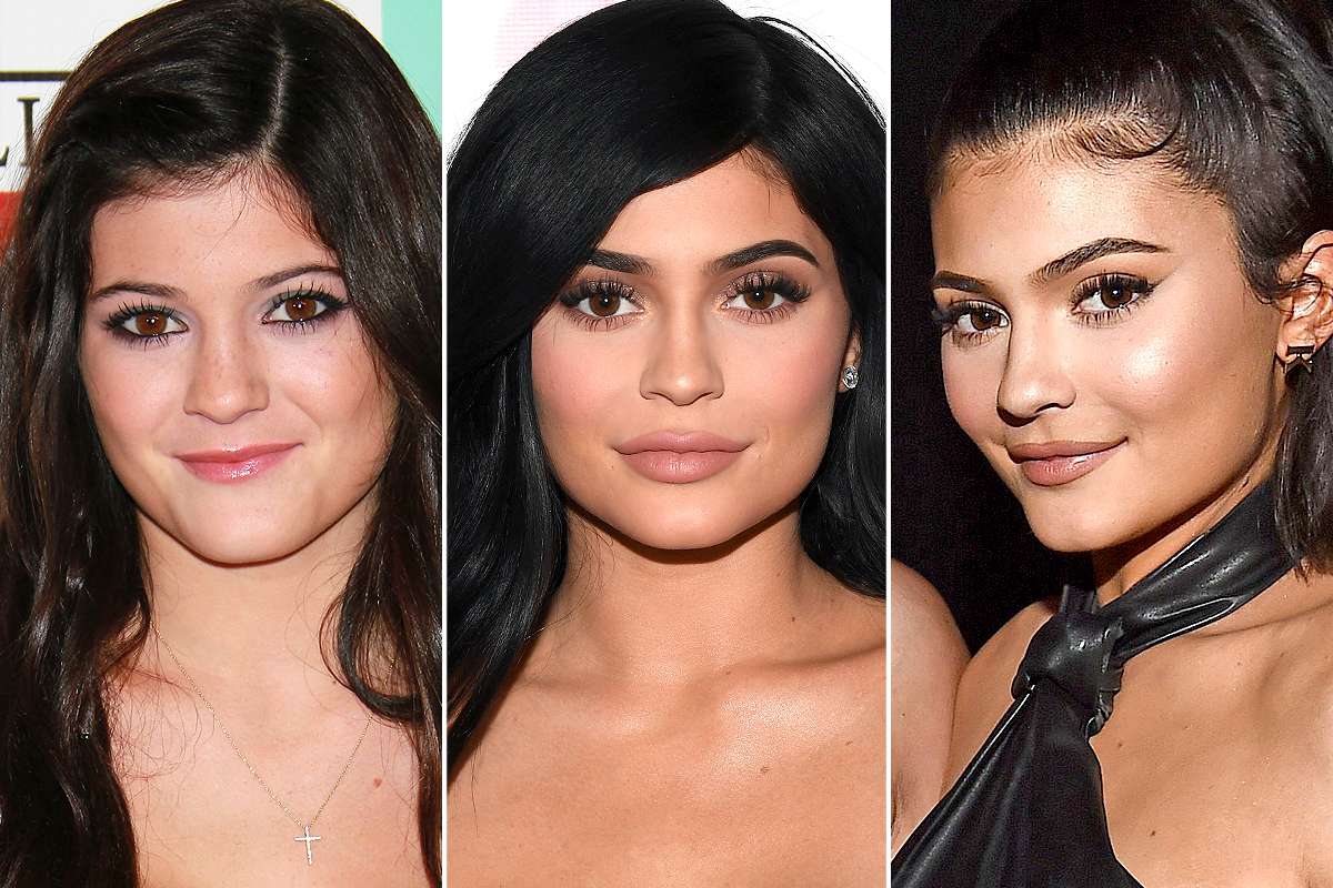 Kylie Jenner e il segreto delle sue labbra perfette - Rifatti ...